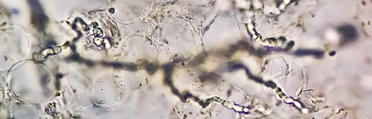 Corso ECM webinar / Animal mycosis and antifungal resistance in an One ...